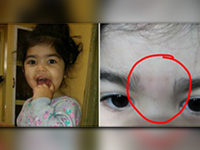 Parents claim daycare waxed toddlers' eyebrows